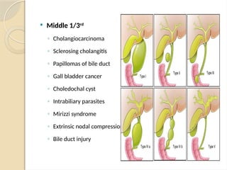 Causes and Clinical Features of Obstructive Jaundice.pptx