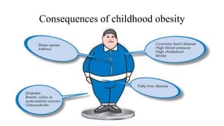 Causes and consequences of childhood obesity power point | PPTX