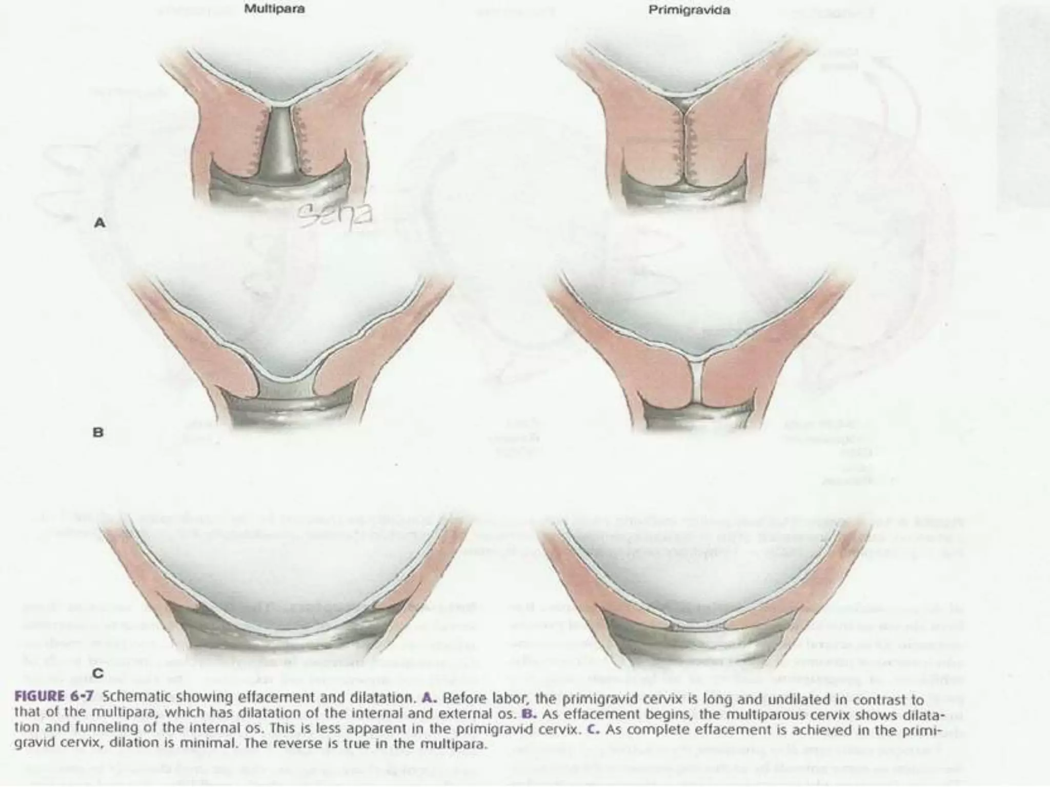 Causes and onset of labour | PPTX