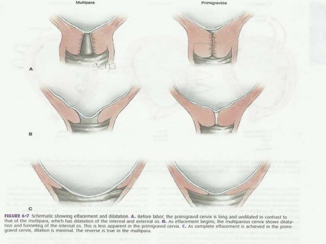 Causes and onset of labour | PPTX | Pregnancy | Reproductive Health