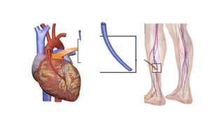 Causes and treatment of chd | PPTX