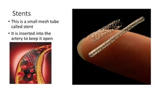 Causes and treatment of chd | PPTX