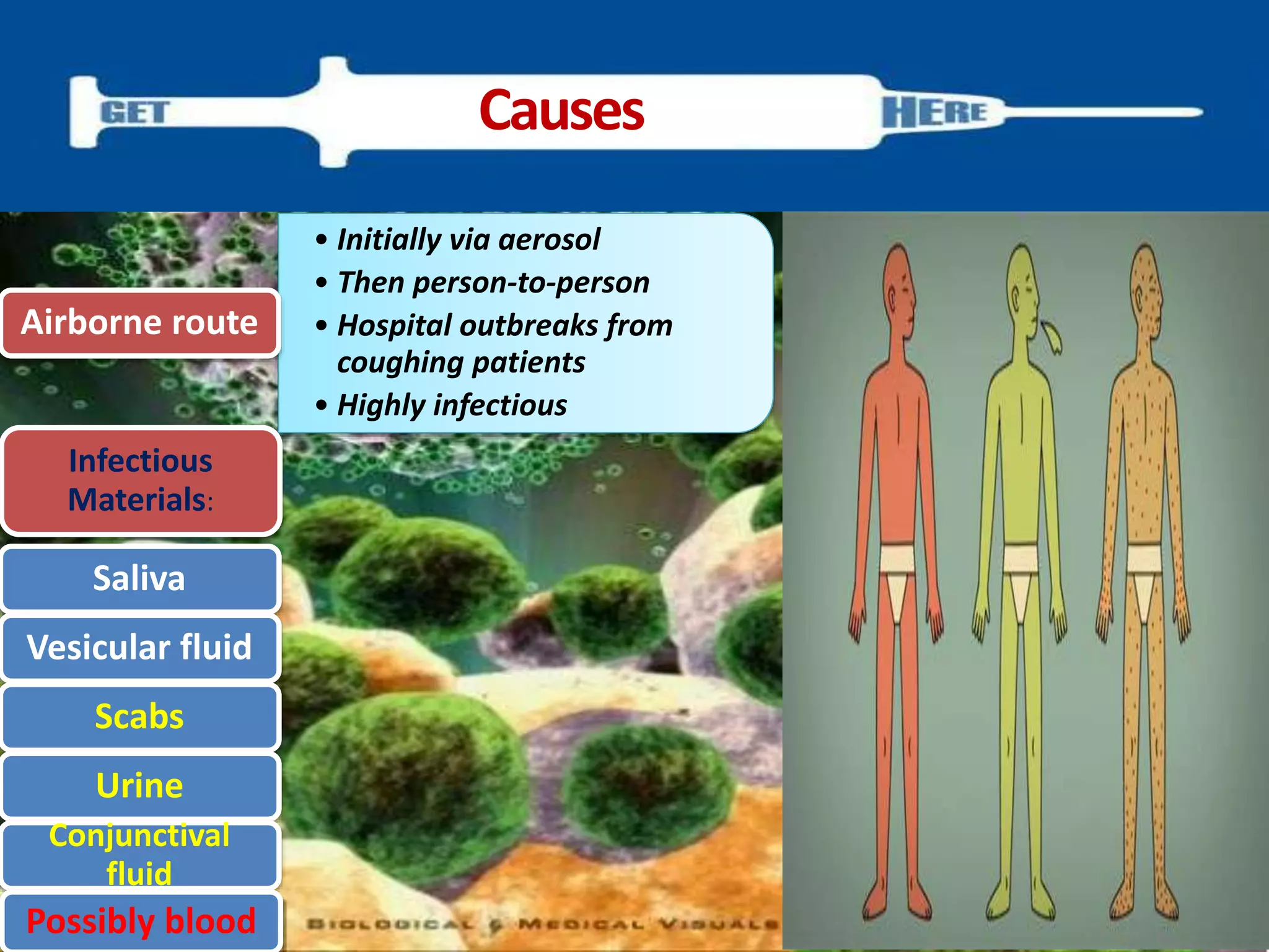 SMALL POX | PPTX | Infectious Diseases | Diseases and Conditions