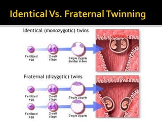 Causes & Complications Of Multiple Births | PPTX