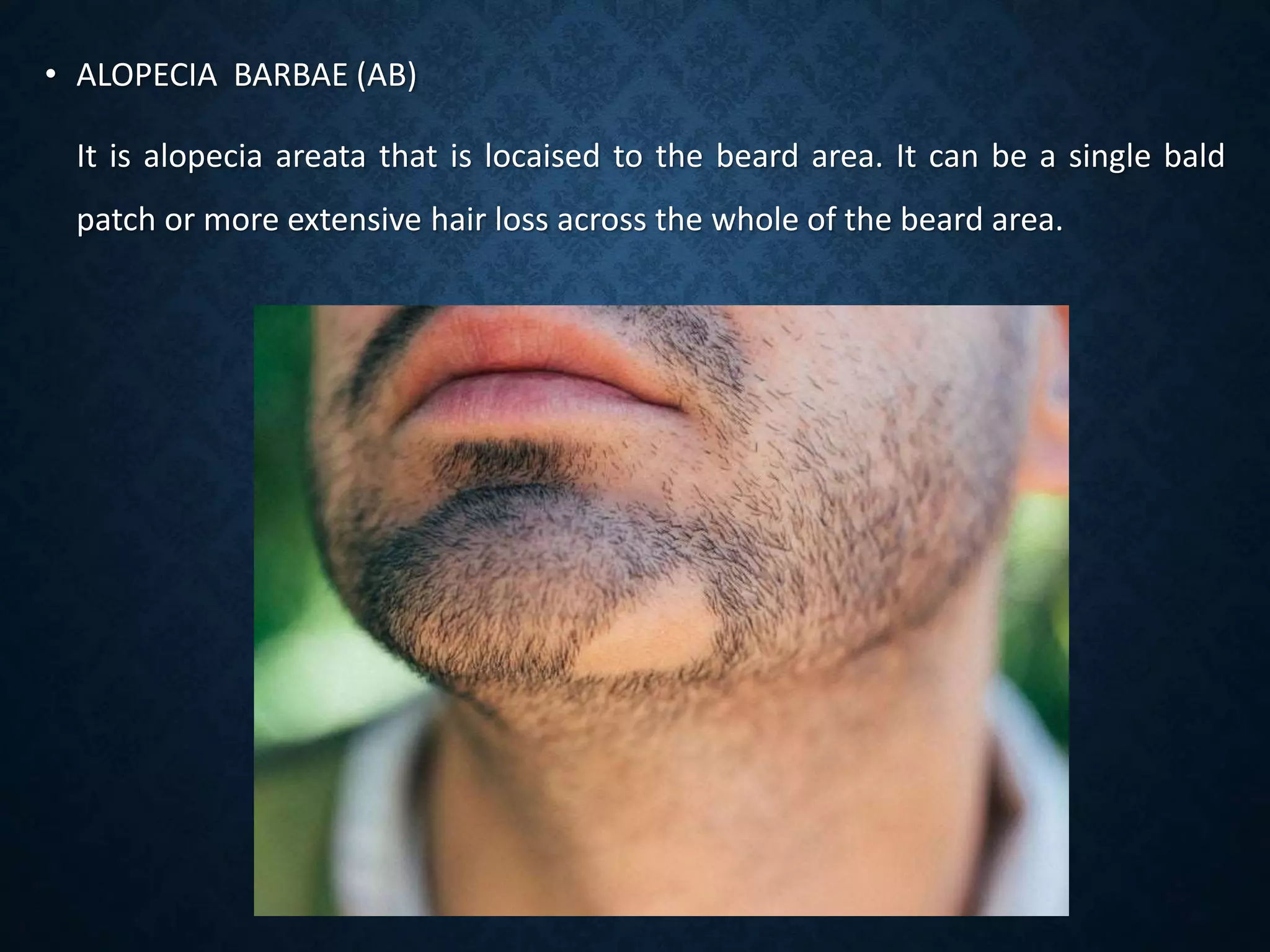Causes of Alopecia.pptx