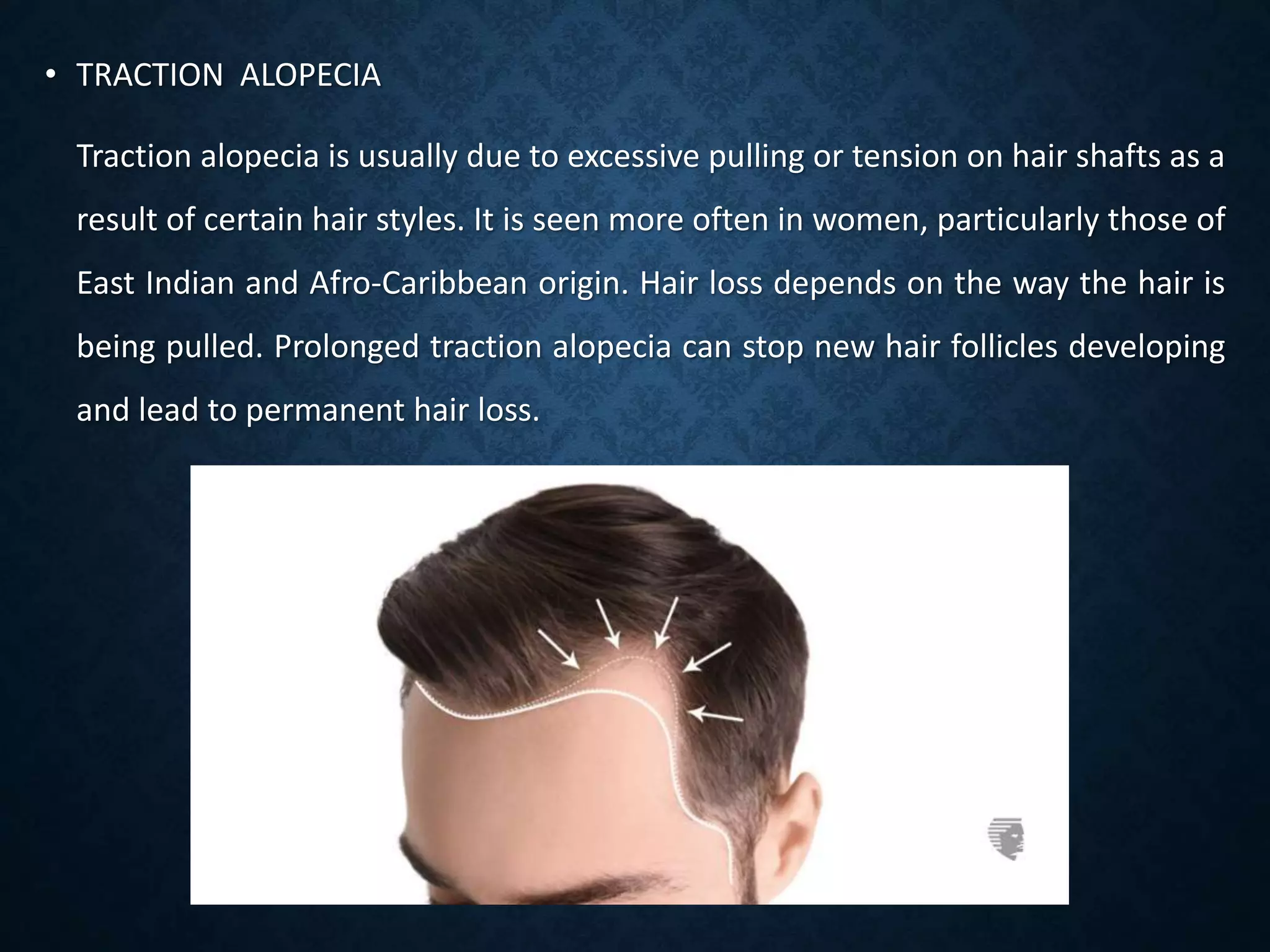 Causes of Alopecia.pptx