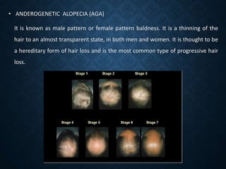 Causes of Alopecia.pptx