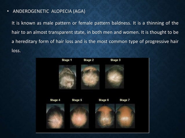 Causes of Alopecia.pptx | Skin and Dermatology | Diseases and Conditions