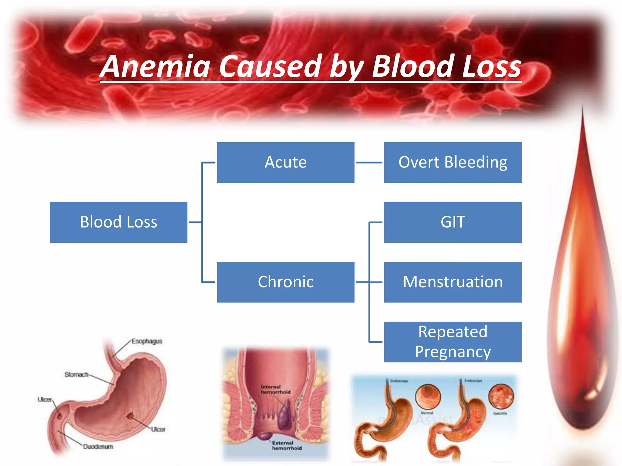 Causes of anemia | PPTX