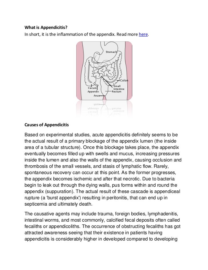 Causes of appendicitis