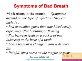 Causes of bad breath | PPT