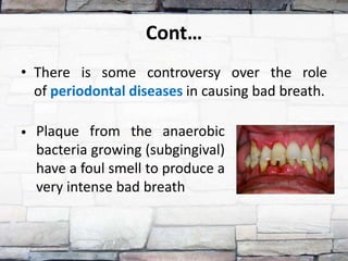 Causes of oral bad odor intrinsic | PPTX