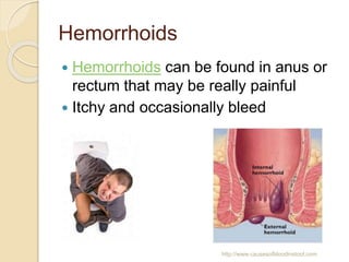 Causes of blood in stool | PDF