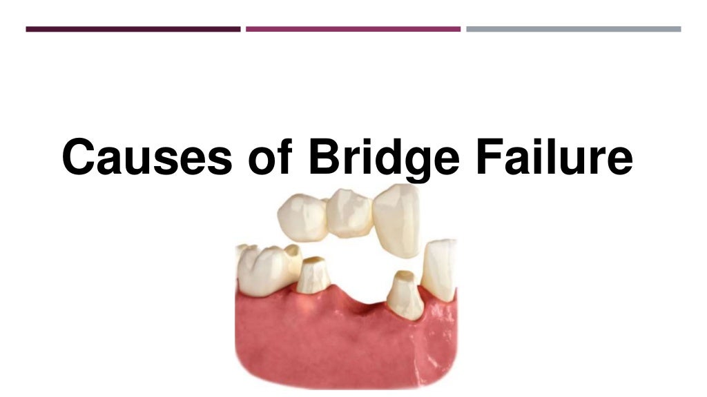 Causes of Bridge Failure SS.pptx
