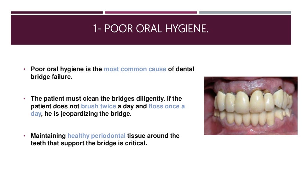Causes of Bridge Failure SS.pptx