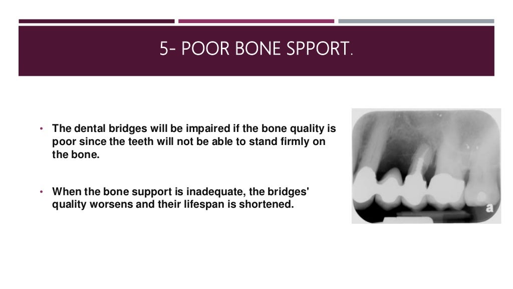 Causes of Bridge Failure SS.pptx