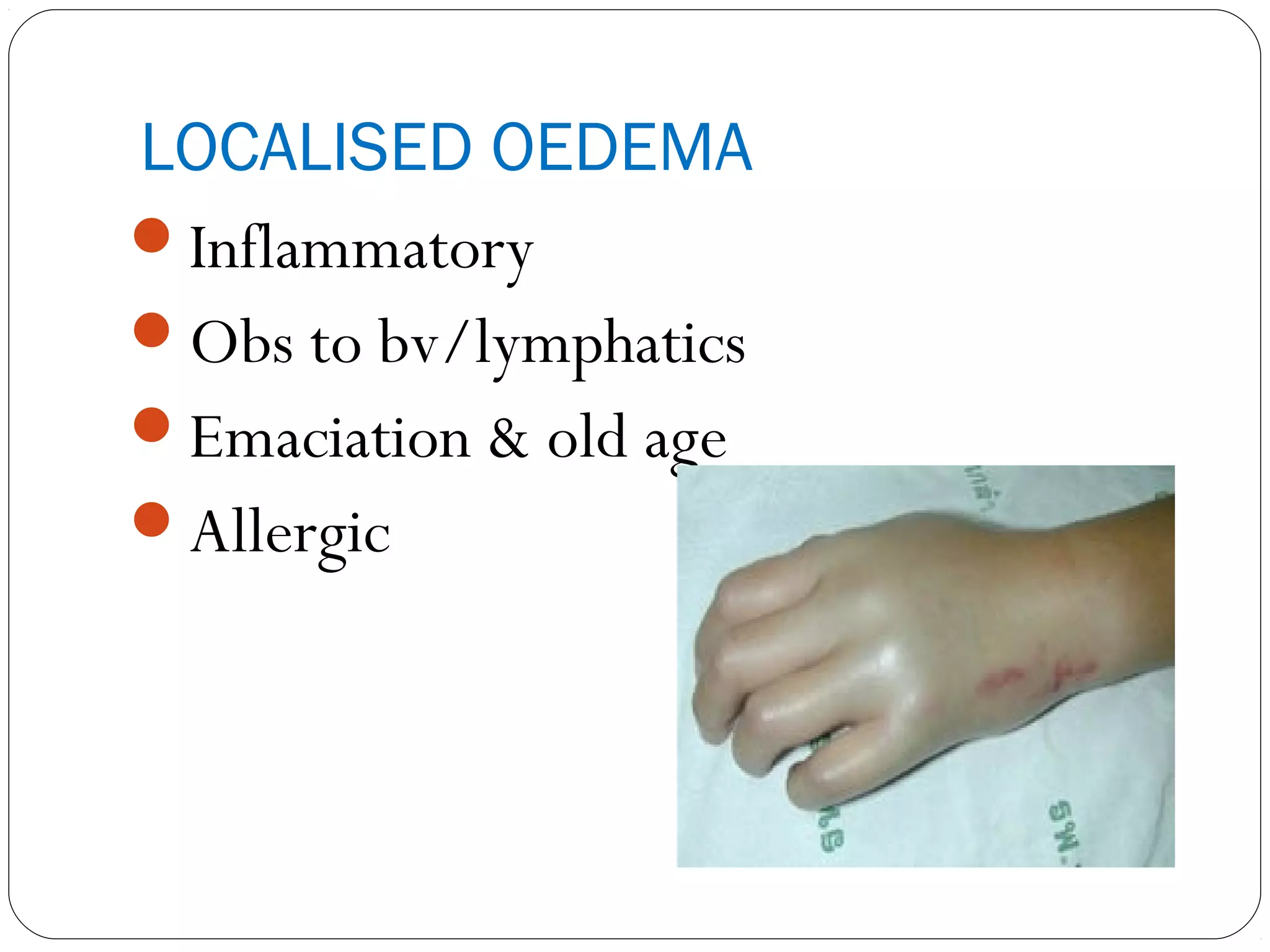 Causes of edema | PPT
