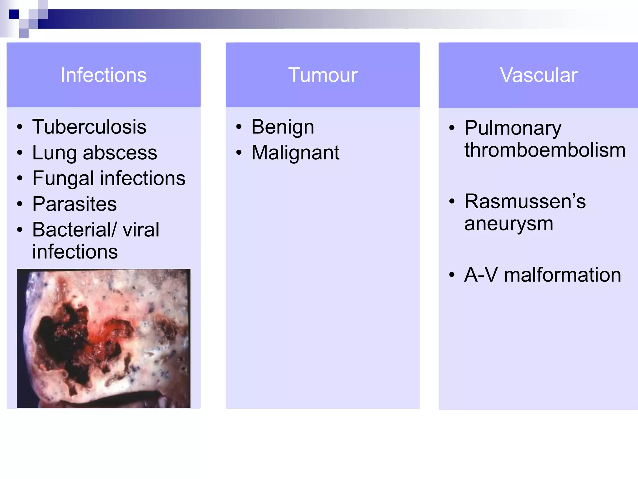 Causes of Haemoptysis | PPTX | Lung and Respiratory Health | Diseases ...