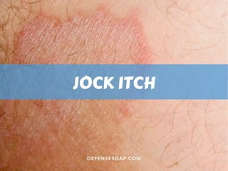 Causes Of Itchy Skin | PPT