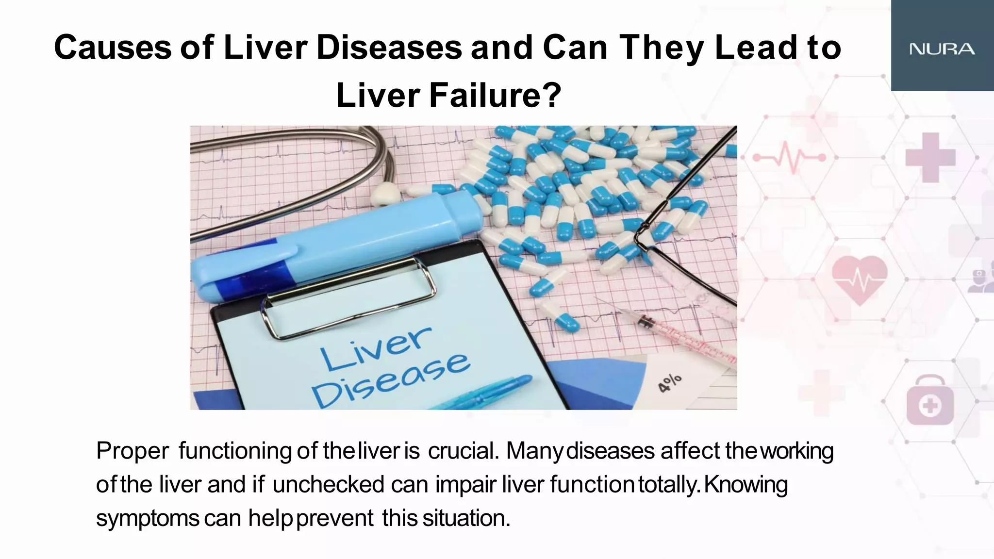 Causes of Liver Diseases and can they lead to Liver Failure ? | PPTX