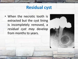 Causes of odontogenic cyst | PPTX | Dental Health | Diseases and Conditions
