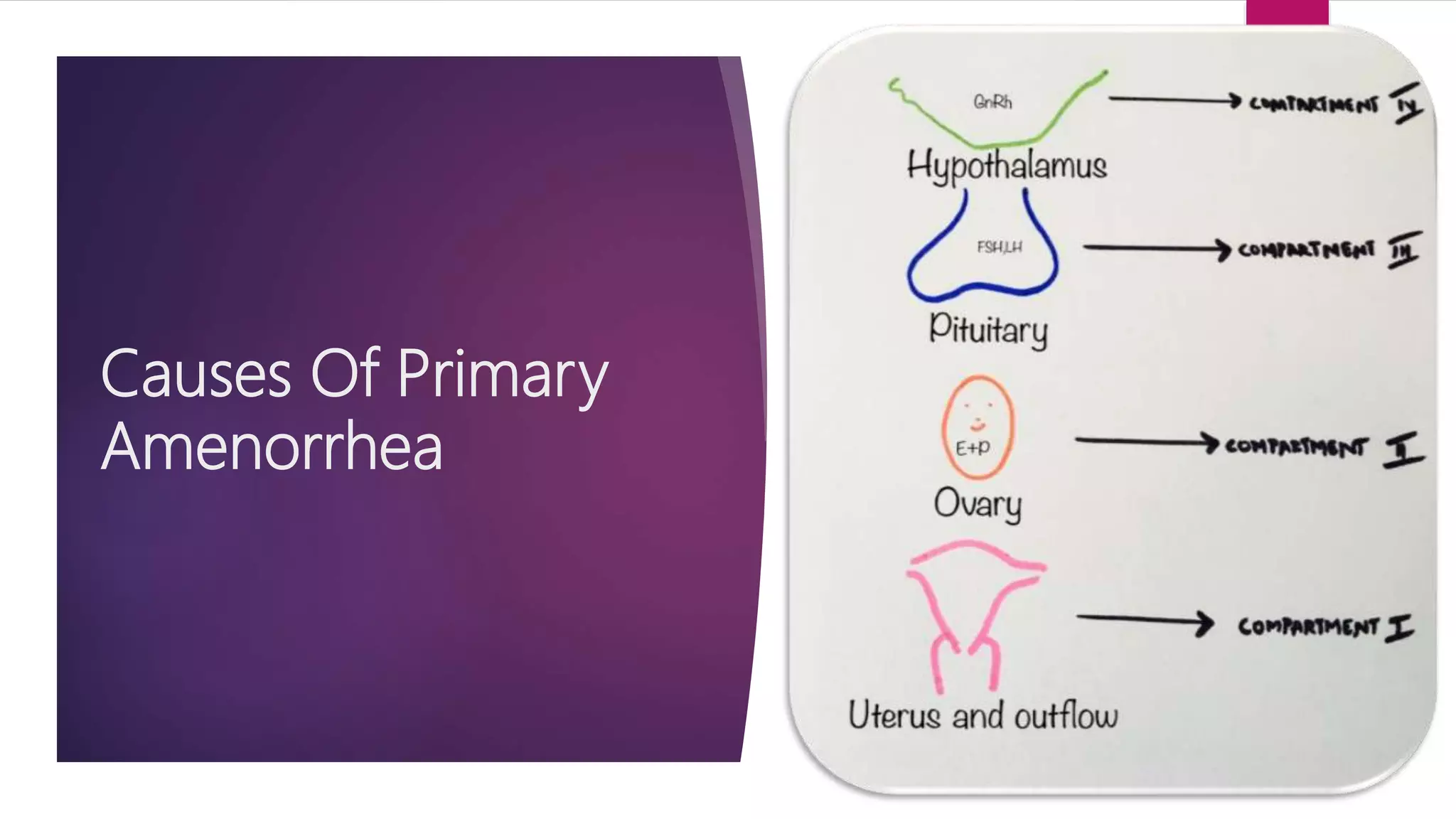 Causes Of Primary Amenorrhea | PPTX