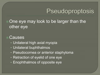 Causes of proptosis | PPTX