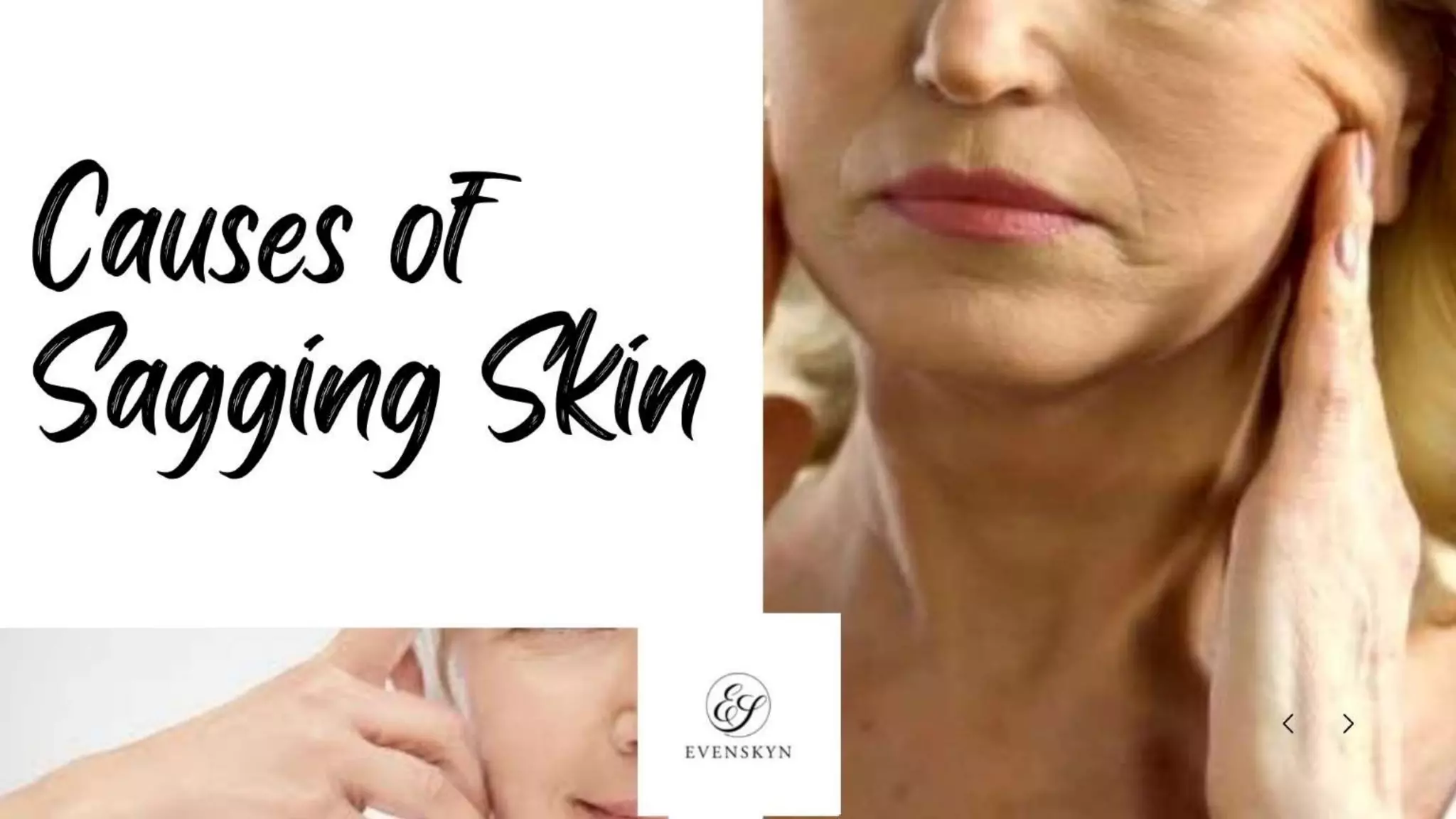 Causes of Sagging Skin | PPT