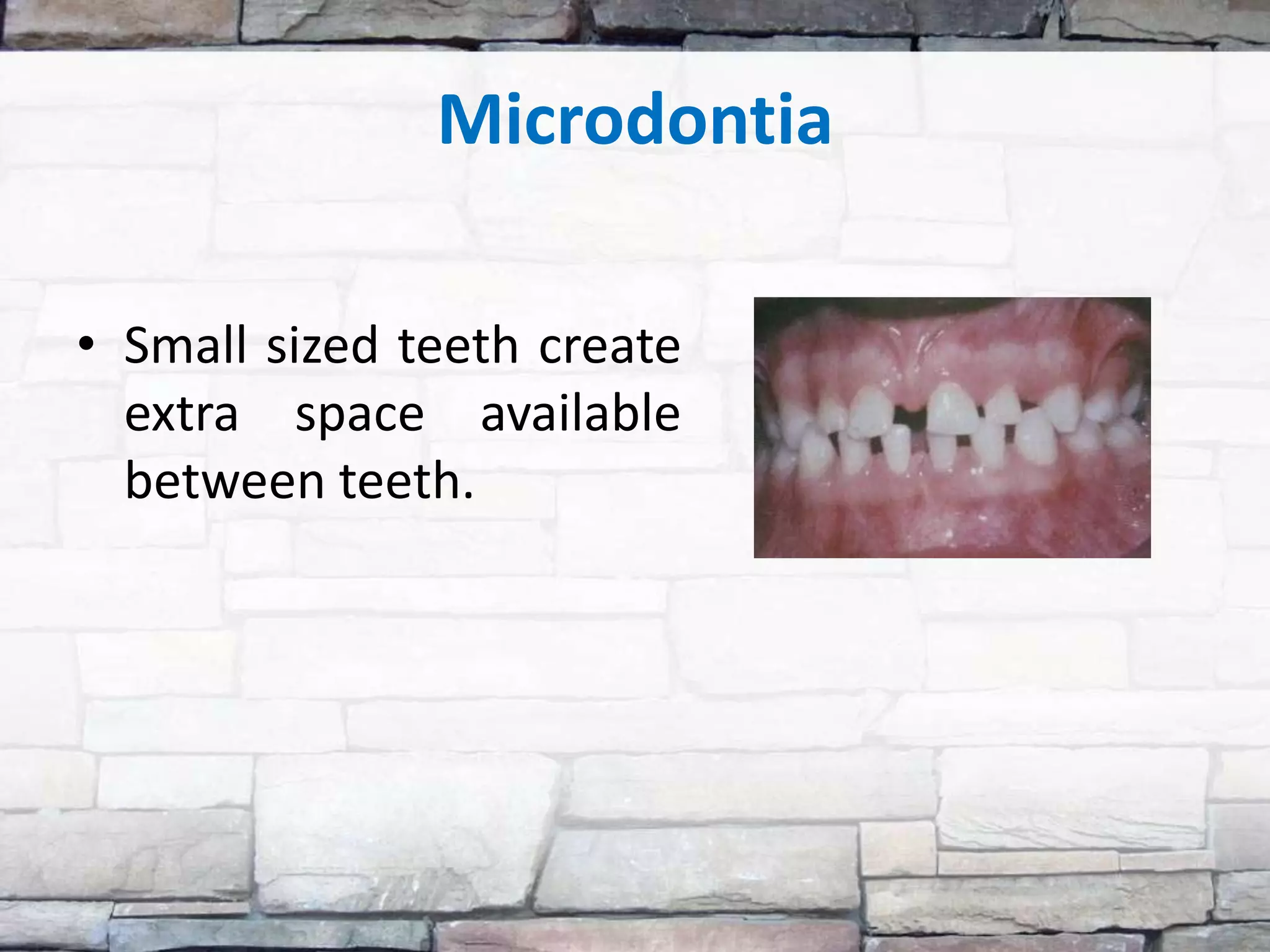 Causes of spacing | PPTX