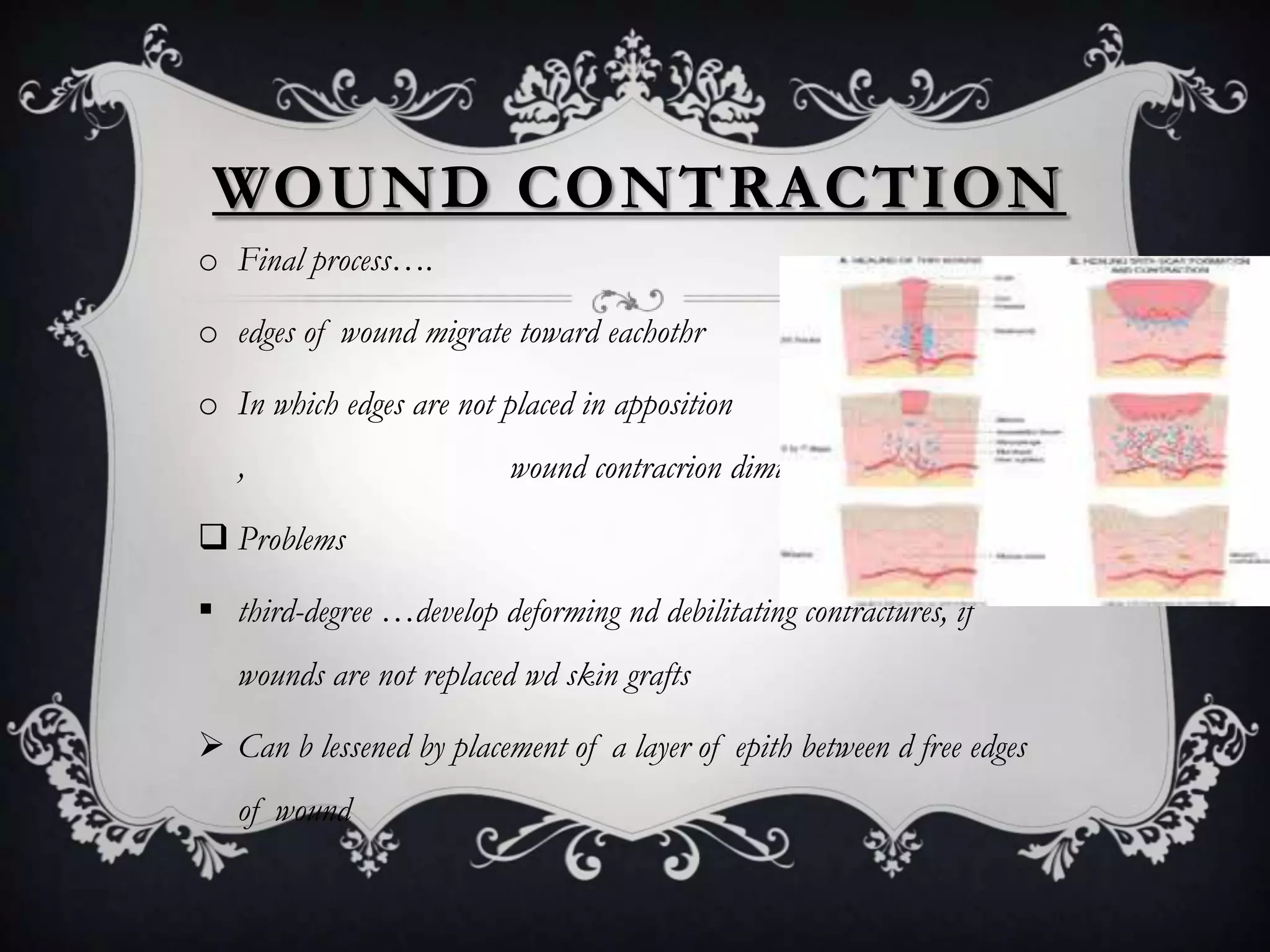 Causes of tissue damage and wound repair | PPTX