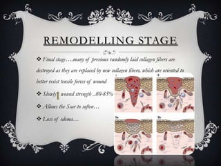 Causes of tissue damage and wound repair | PPTX | Death, Injury, or ...