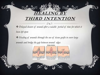 Causes of tissue damage and wound repair | PPTX | Death, Injury, or ...