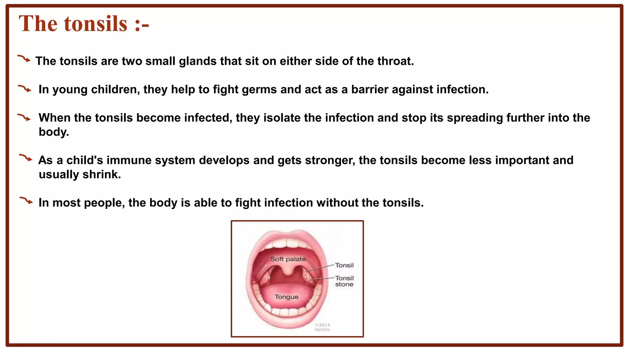 Causes of tonsillitis.pptx