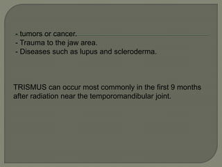 Causes of trismus | PPTX