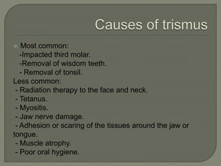 Causes of trismus | PPT