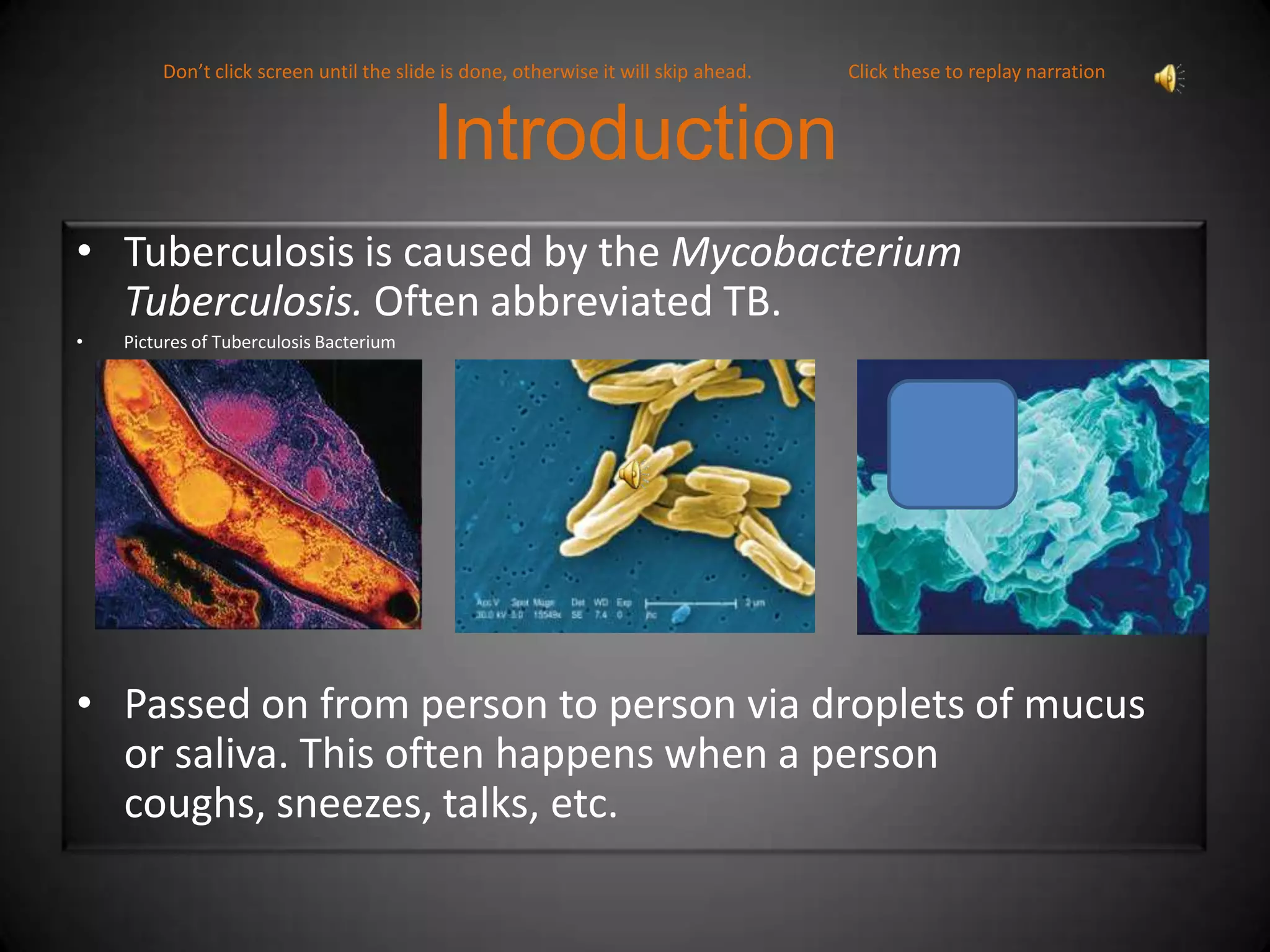 CAUSES OF TUBERCULOSIS POWERPOINT | PPTX