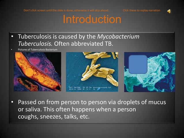 CAUSES OF TUBERCULOSIS POWERPOINT | PPTX