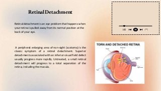Causes of VFD Field defects.pptx