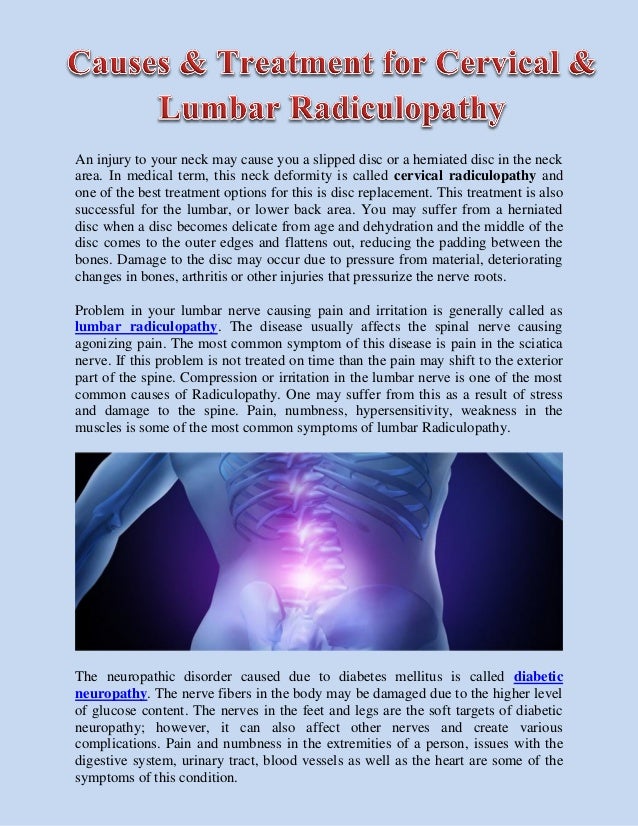 Causes Treatment For Cervical Lumbar Radiculopathy causes-treatment-for-cervical-lumbar-radiculopathy
