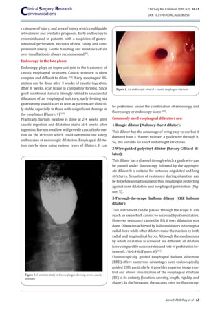Caustic esophageal stricture from diagnosis untill cure | PDF