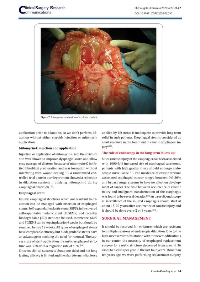Caustic esophageal stricture from diagnosis untill cure | PDF ...