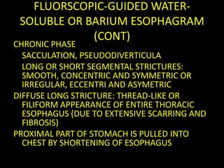 Caustic esophagitis | PPTX