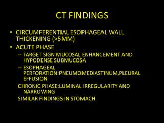 Caustic esophagitis | PPTX