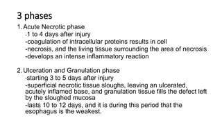 Caustic Ingestion.pptx