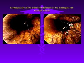 Caustic injury | PPT