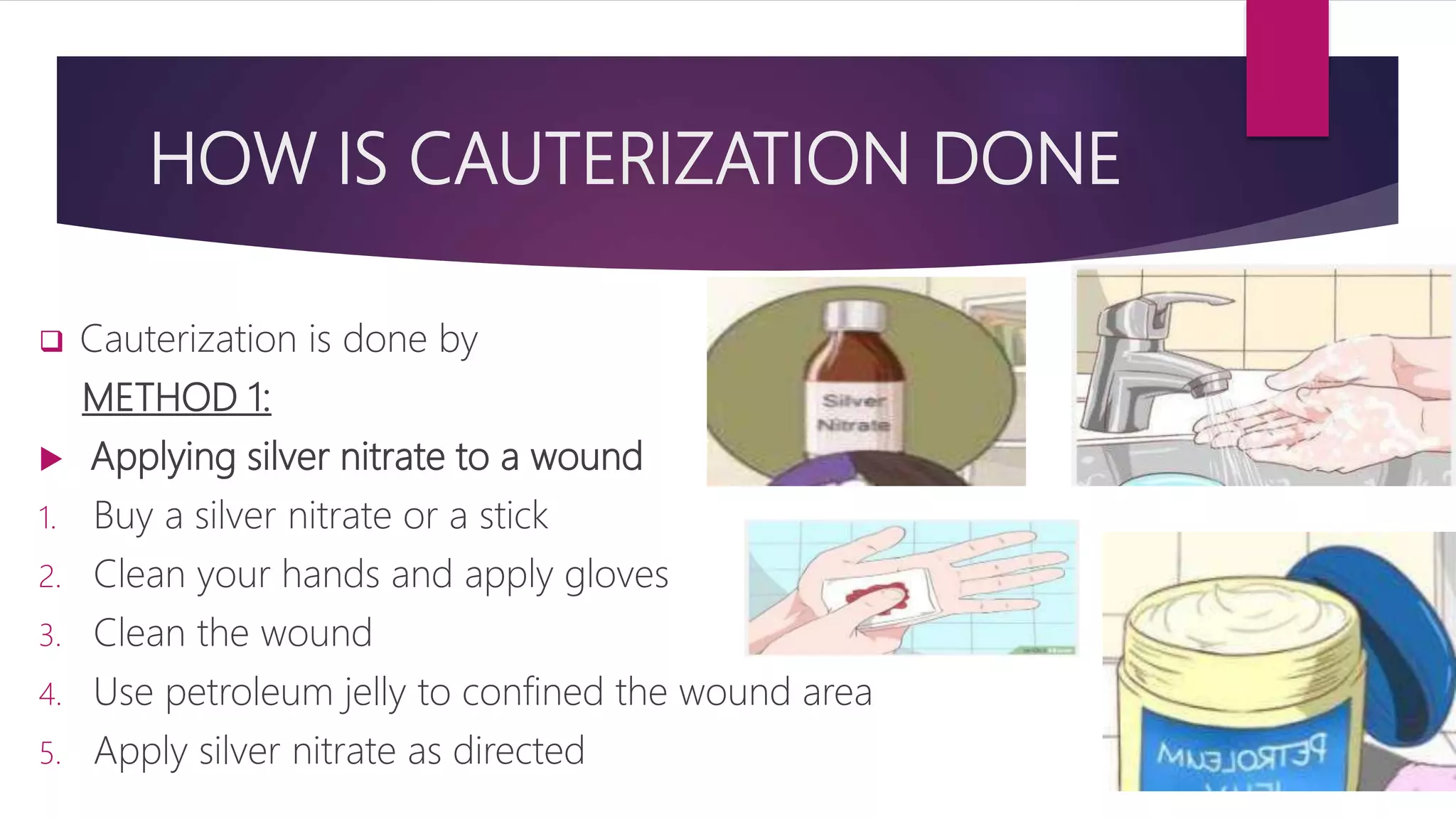 Cauterization | PPTX