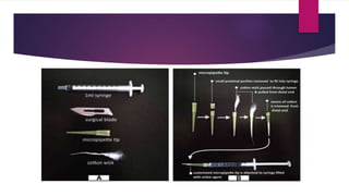 Cauterization | PPTX