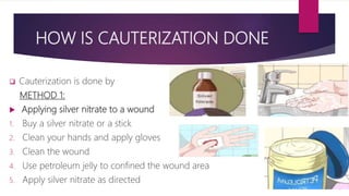 Cauterization | PPTX
