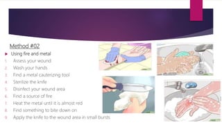 Cauterization | PPTX