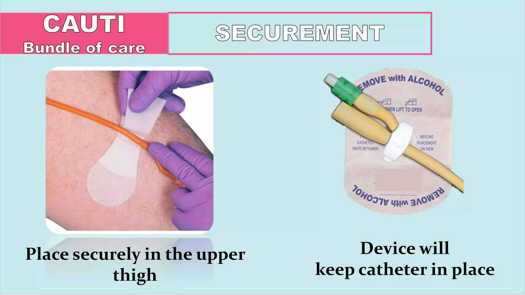 Cauti bundle of care | PPTX